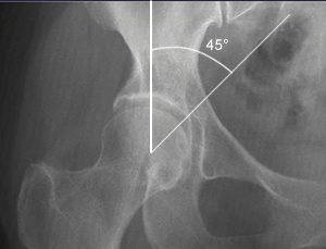Becken / Hüfte Arzt | OrthoRad